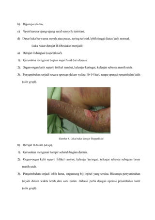 Askep Luka Bakar | DOCX