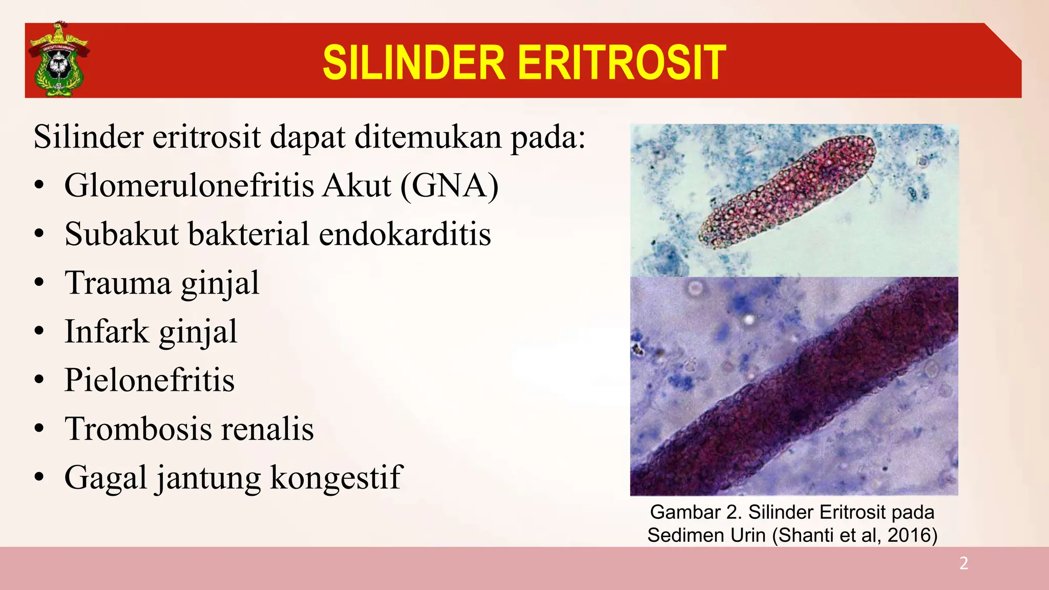 Tugas Kuliah Ginjal Hipertensi Silinder Eritrosit | PPT