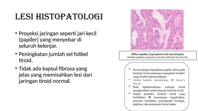 TugasPA untuk pembelajaran mahasiswa kedokteran tentang patologi ...