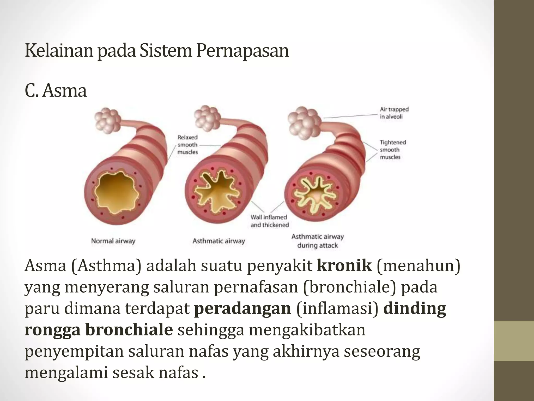 Patofisiologi sistem pernapasan | PPTX