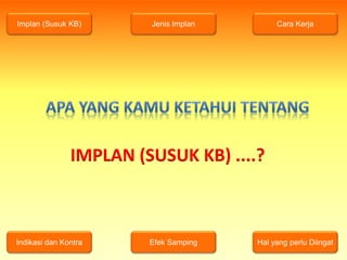 Kb Implan | PPTX
