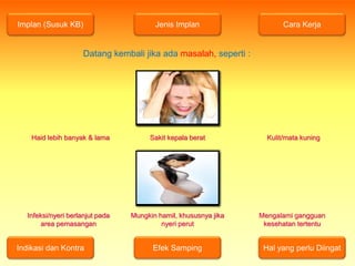 Kb Implan | PPTX