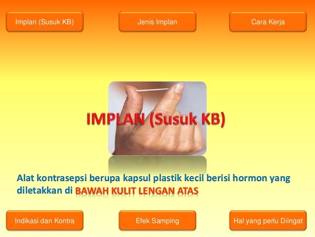 Kb Implan