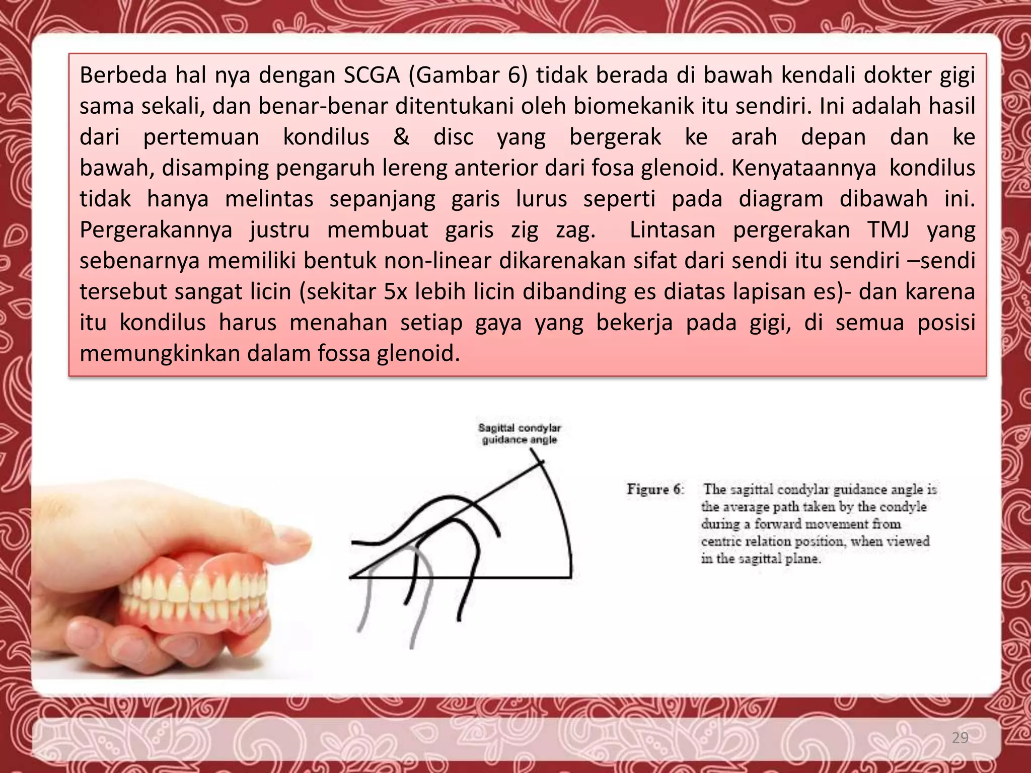 Tugas ppt oklusi pada gtp | PPTX