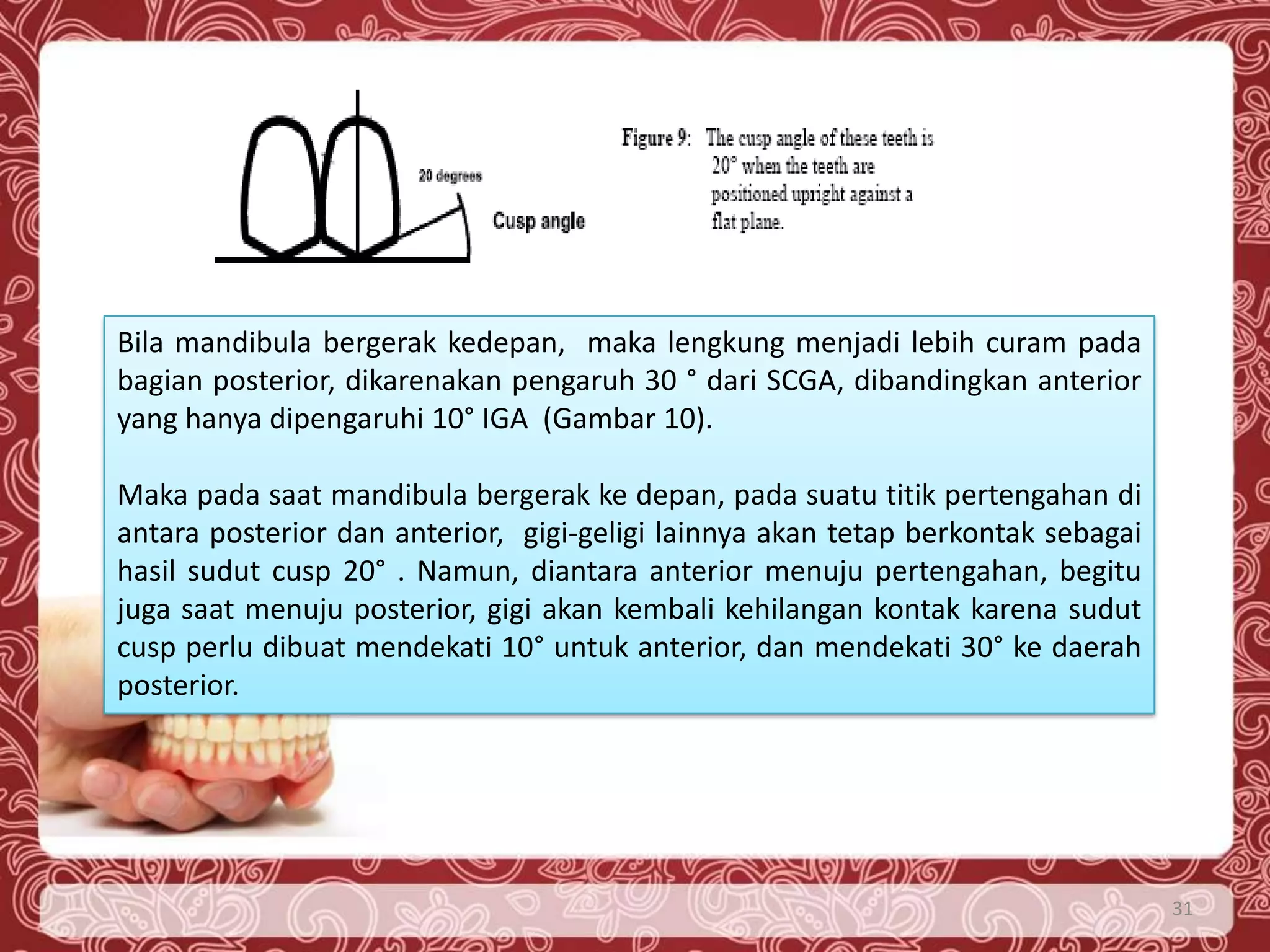 Tugas ppt oklusi pada gtp | PPTX