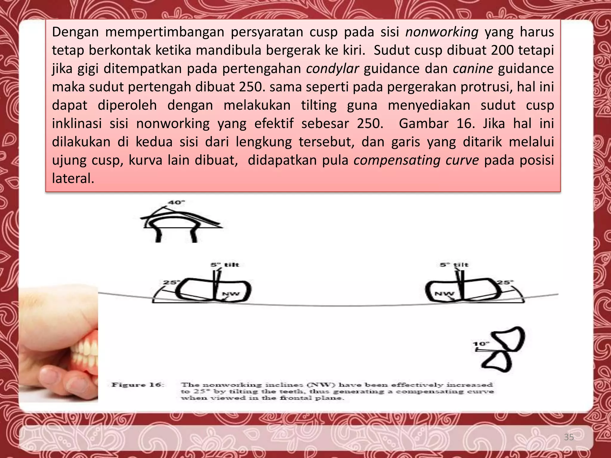 Tugas ppt oklusi pada gtp | PPTX