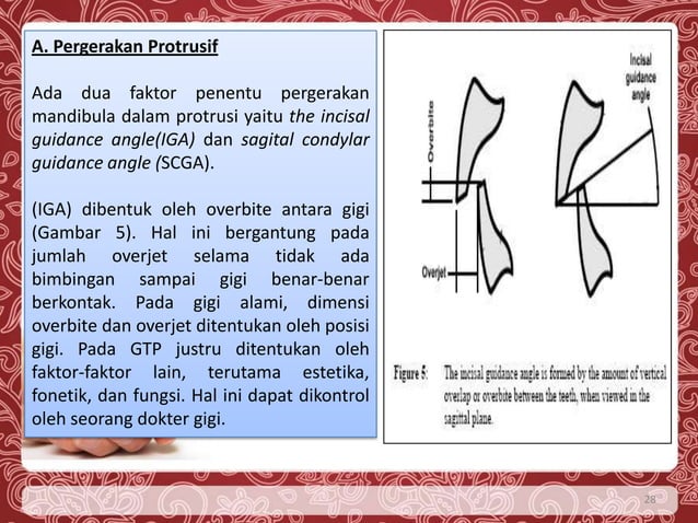 Tugas ppt oklusi pada gtp | PPTX