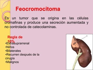 Tumores de glándula suprarrenal | PPTX
