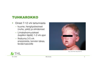 Tuhkarokko ja mpr rokotukset | PDF