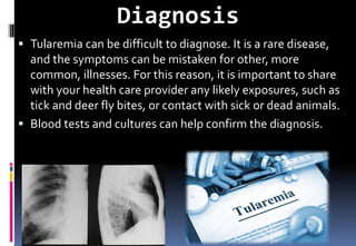 Tularemia | PPTX
