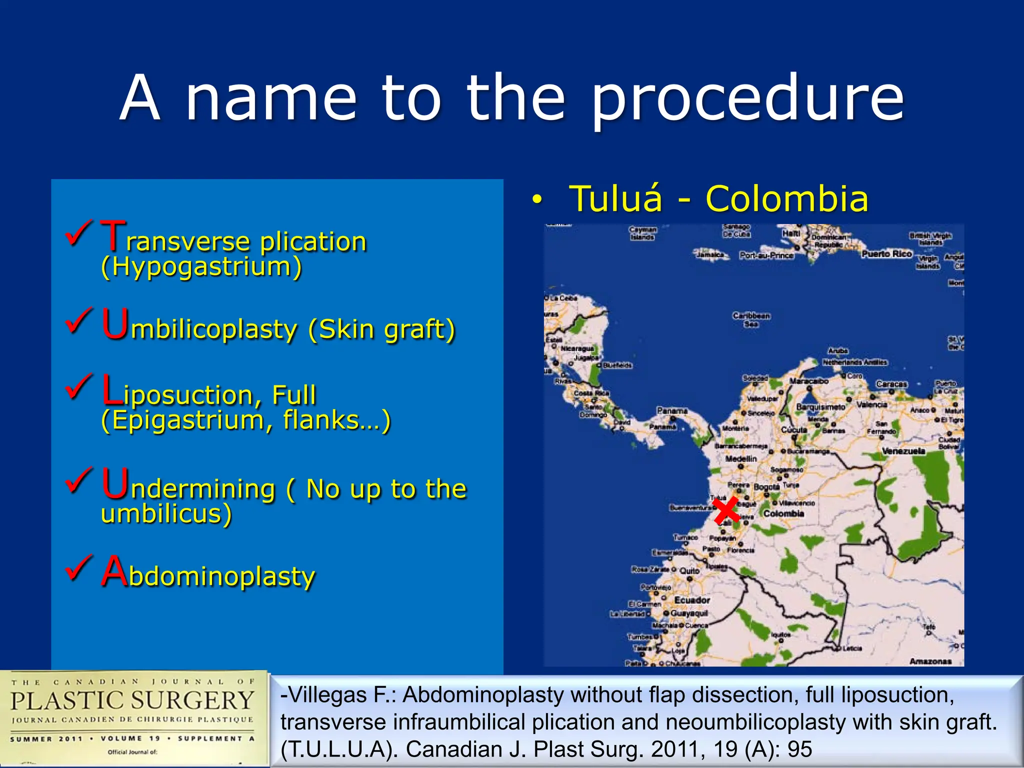 TULUA Abdominoplasty the new modified technique for pendulous abdomen | PDF