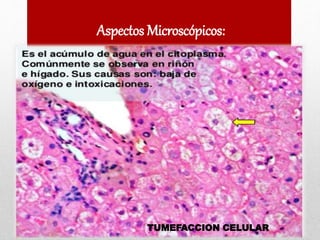 Tumefacción Celular | PPTX