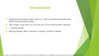 Tumefactive Demyelinating Lesions | PPTX