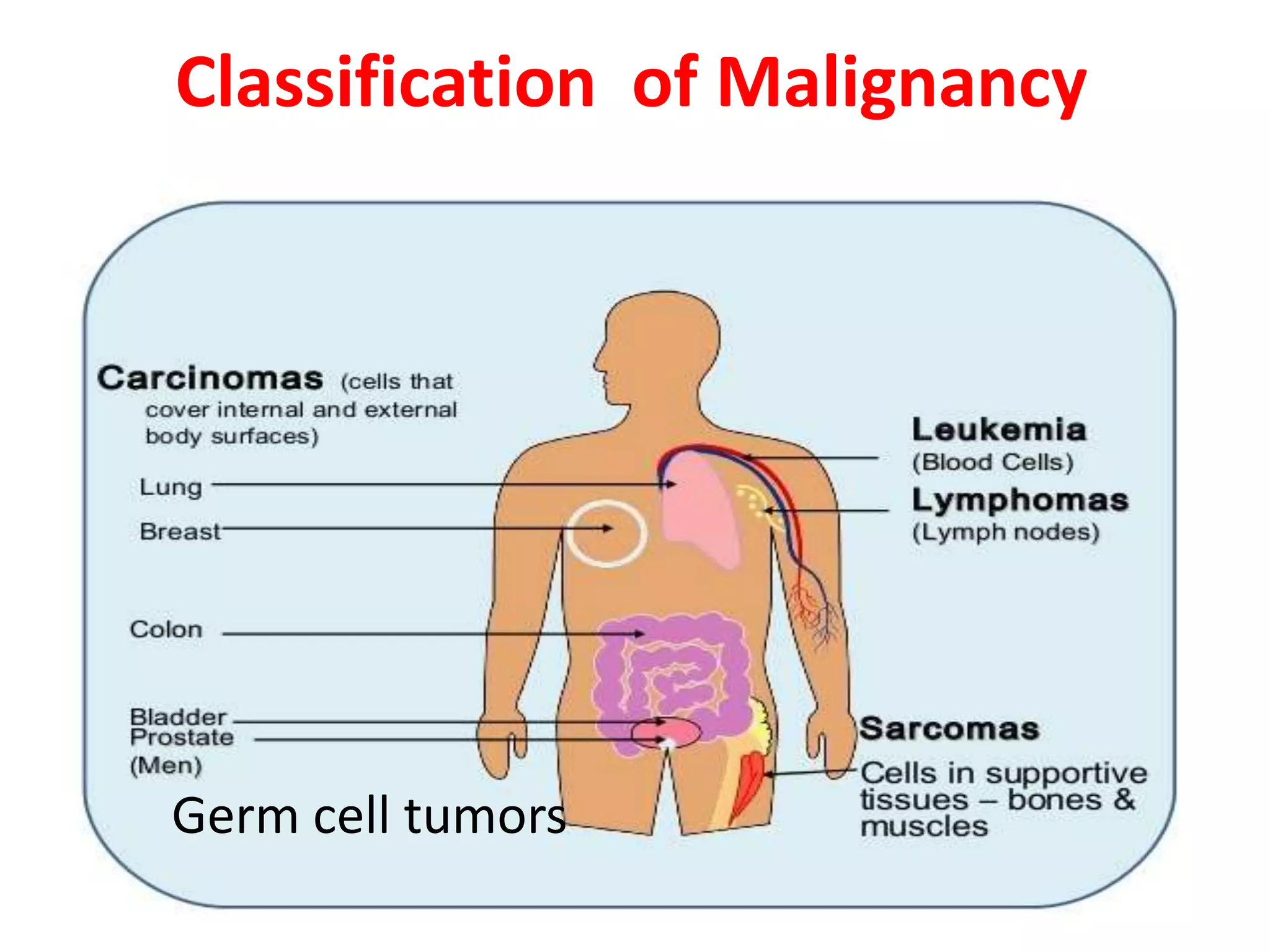 Introduction to Pathophysiology of Tumors | PPTX