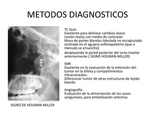 Tumoraciones nasosinusales | PPTX