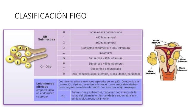 Hemorragia uterina anormal FIGO