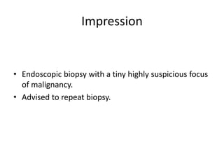 Tumor board ca stomach 28082018 | PPTX