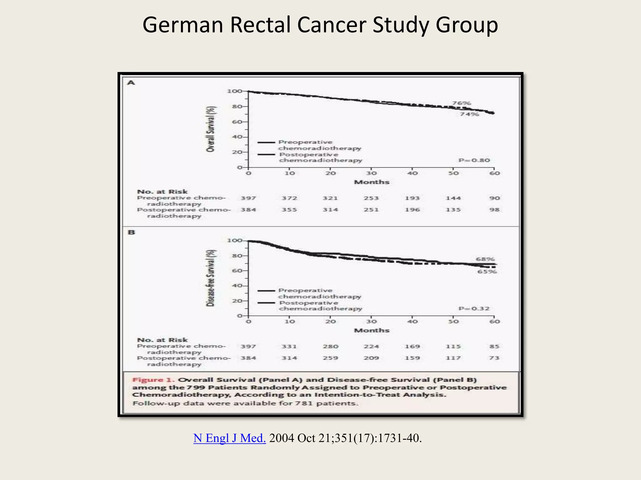 Tumor board locally advanced rectal cancer | PPTX