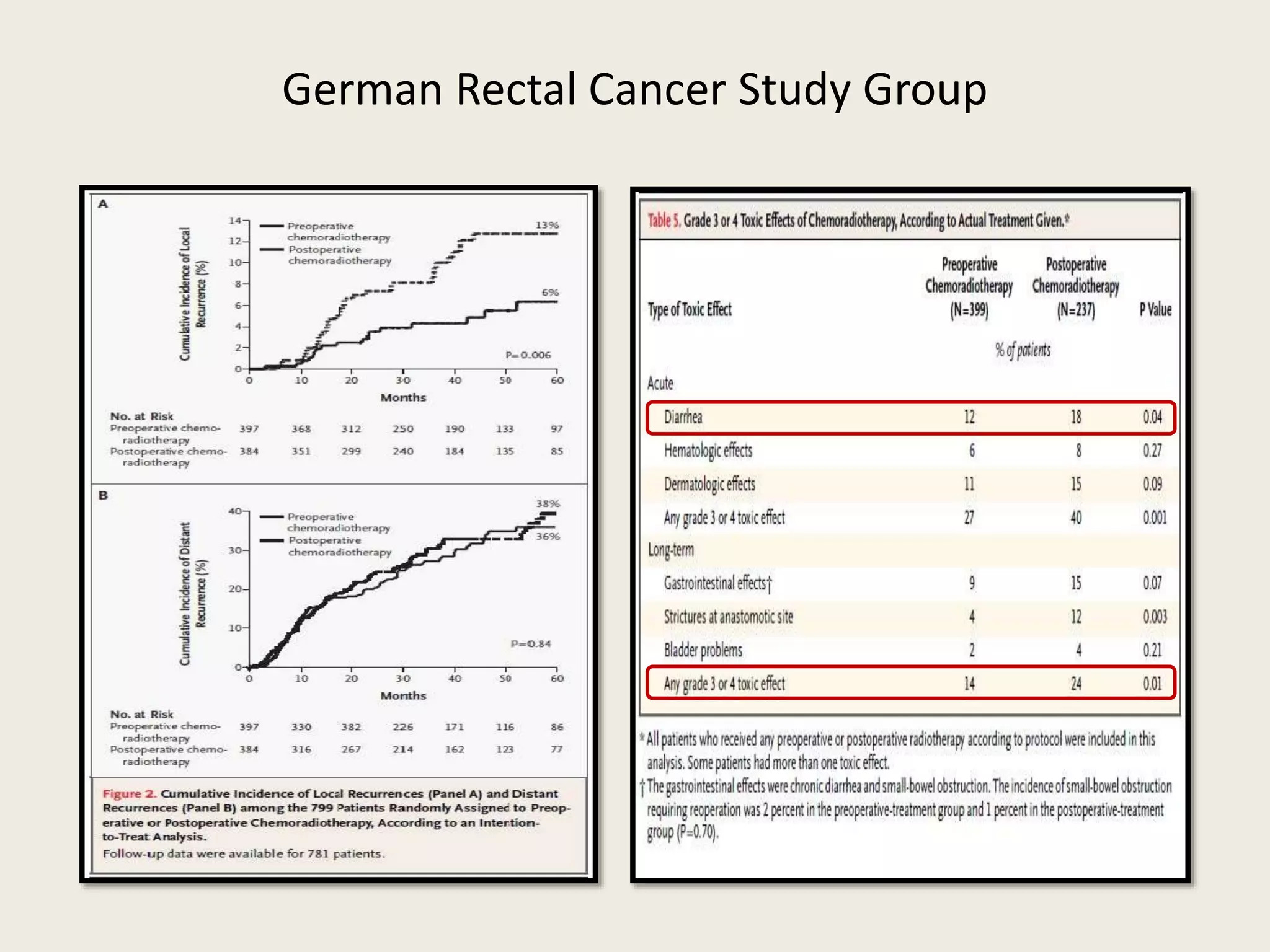Tumor board locally advanced rectal cancer | PPTX