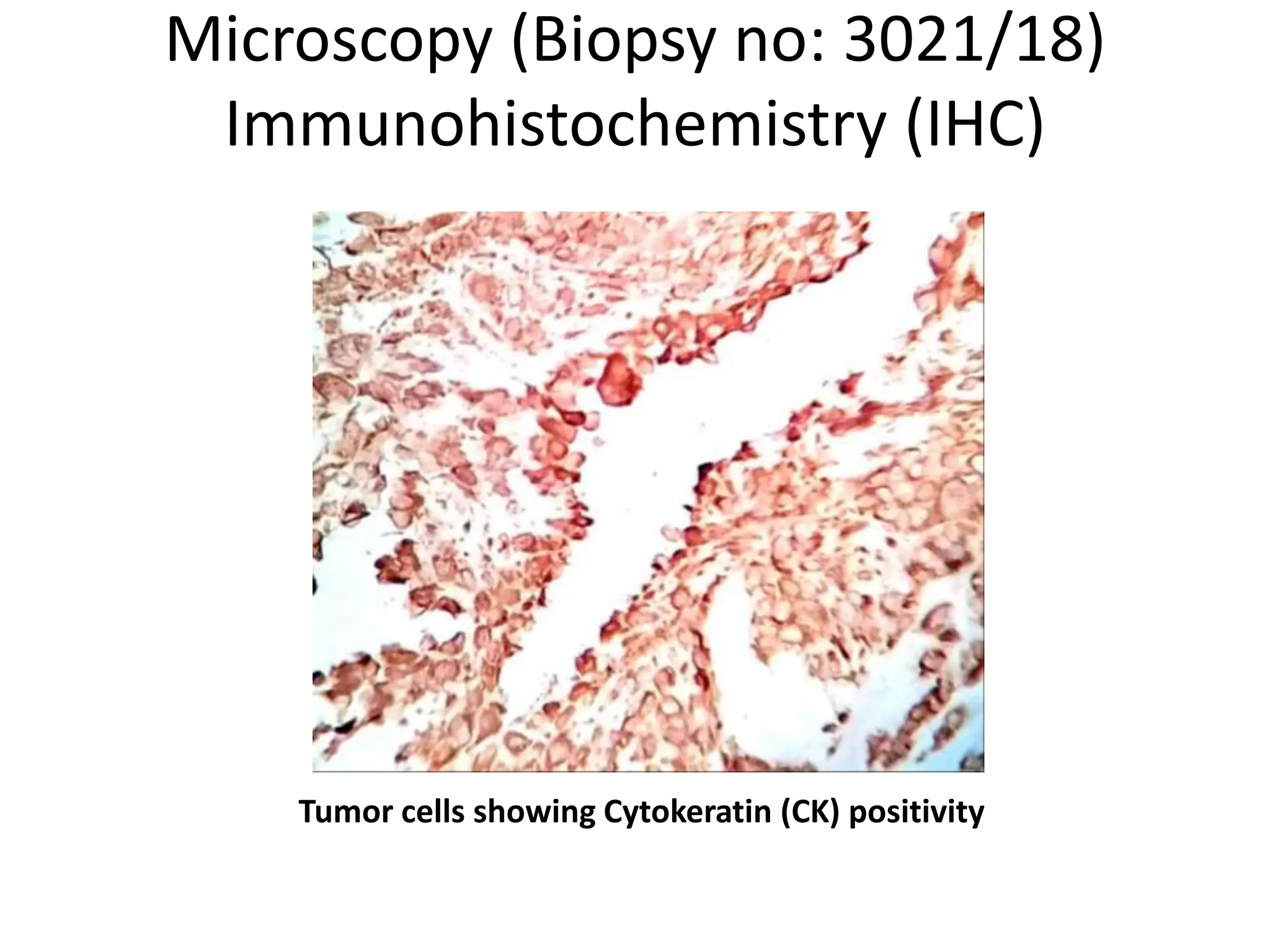 Tumor board soft tissue sarcoma | PPT