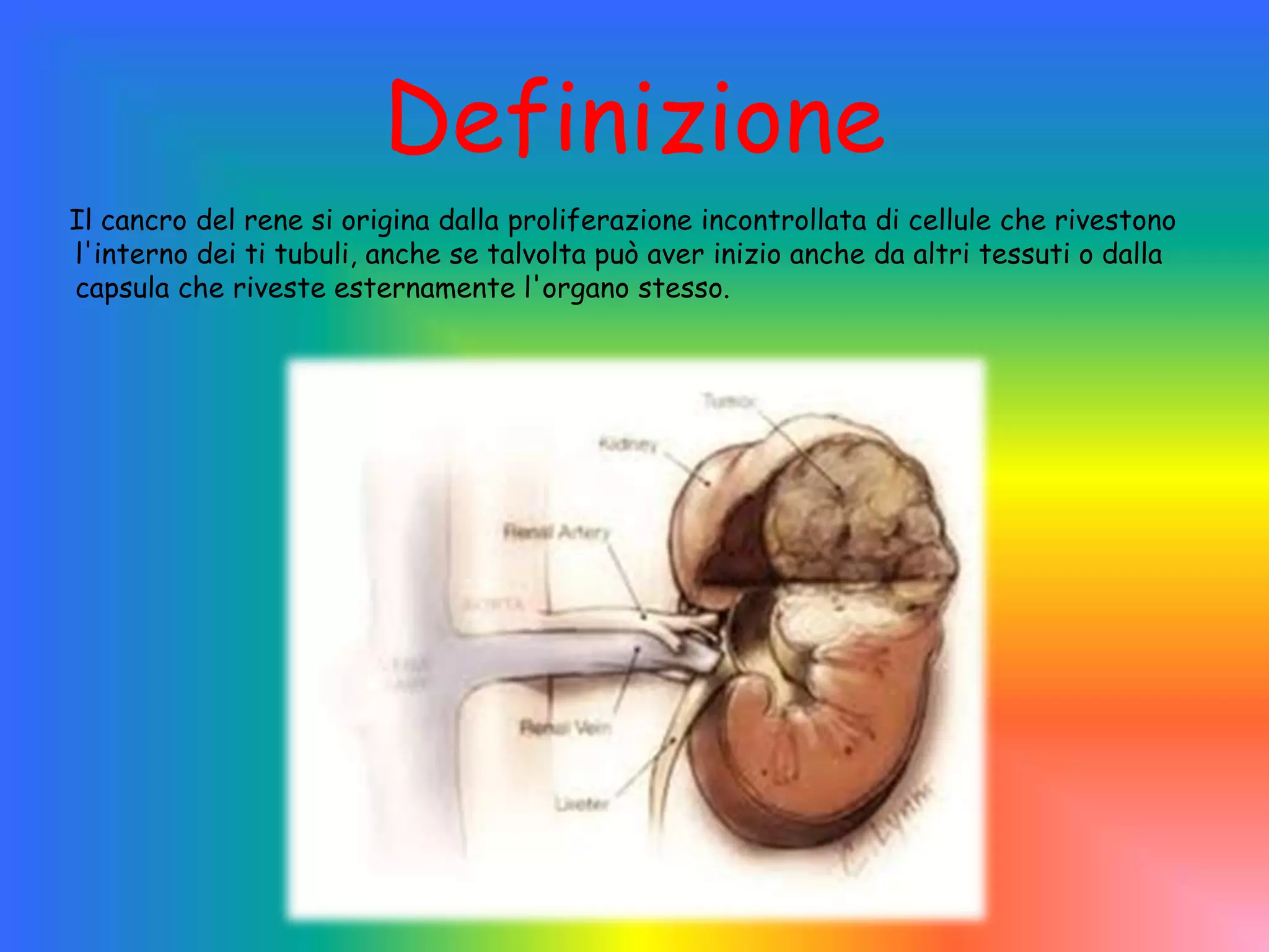 Tumore ai reni | PPTX