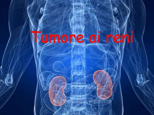 Tumore ai reni | PPTX | Cancer | Diseases and Conditions
