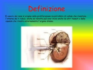 Tumore ai reni | PPTX