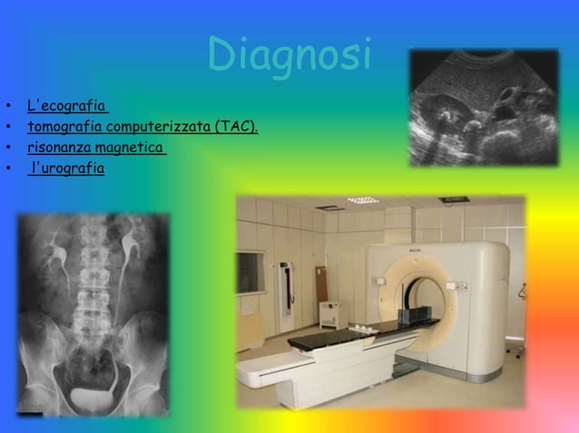 Tumore ai reni | PPTX | Cancer | Diseases and Conditions