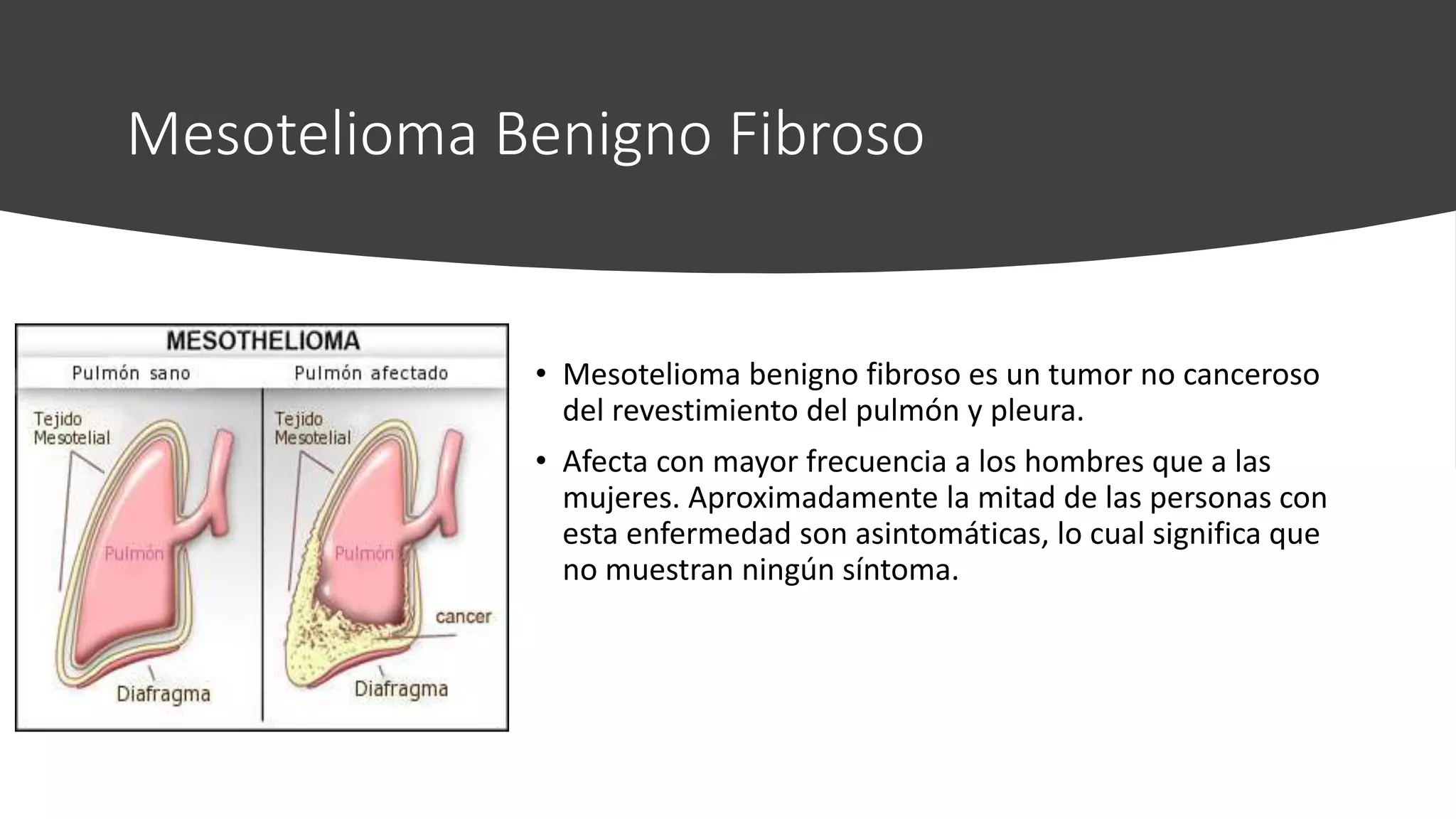 Tumores benignos de pulmon | PPTX