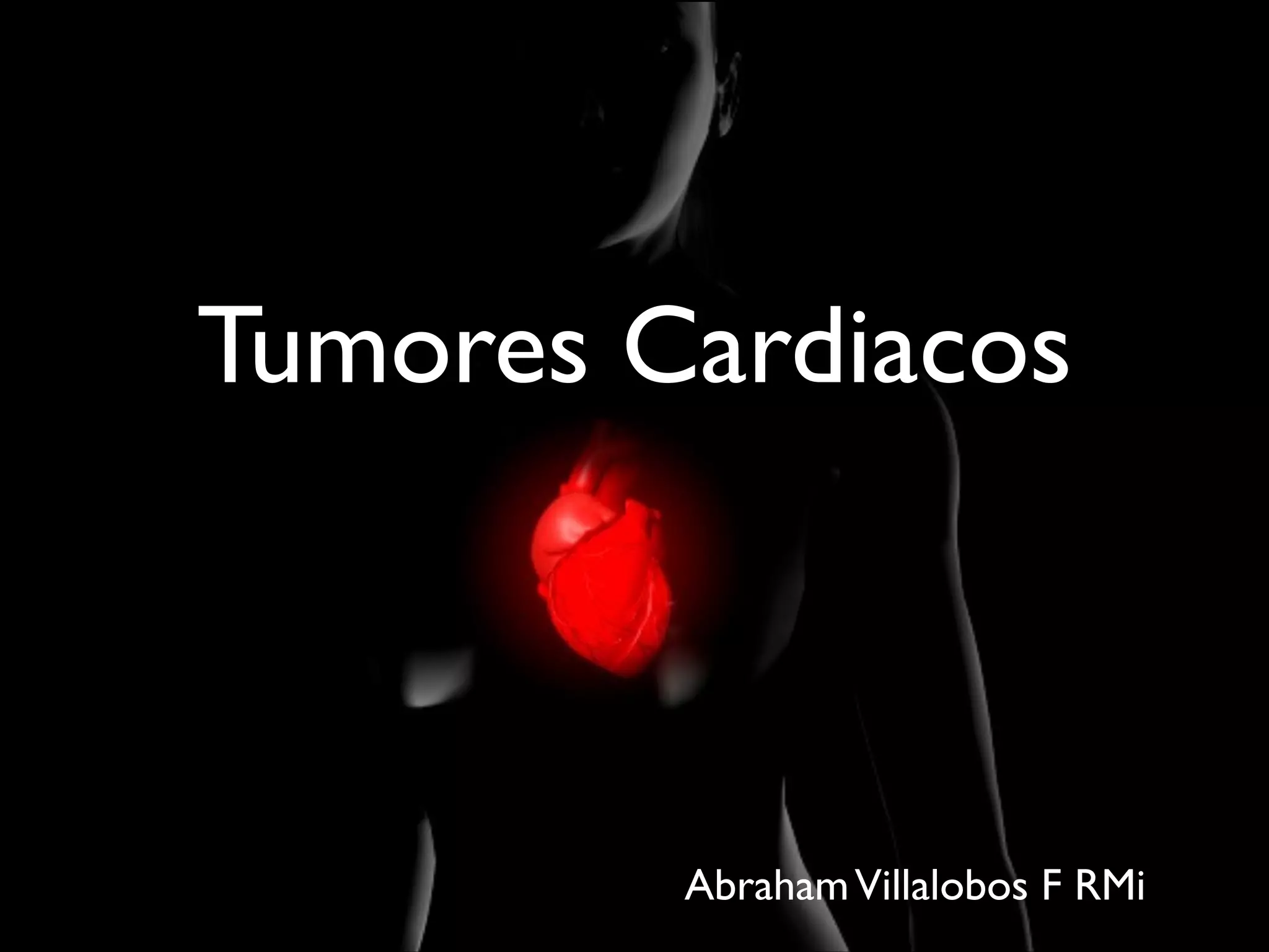 Tumores cardiacos | PDF | Heart and Cardiovascular Diseases | Diseases ...