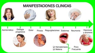 Tumores de esofago | PDF