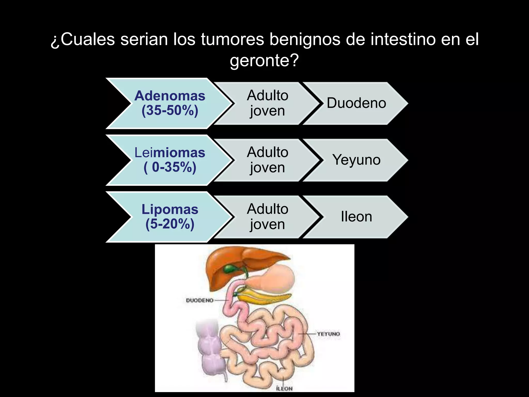 Tumores de intestino delgado tnm. ekipo 6 2 | PPTX