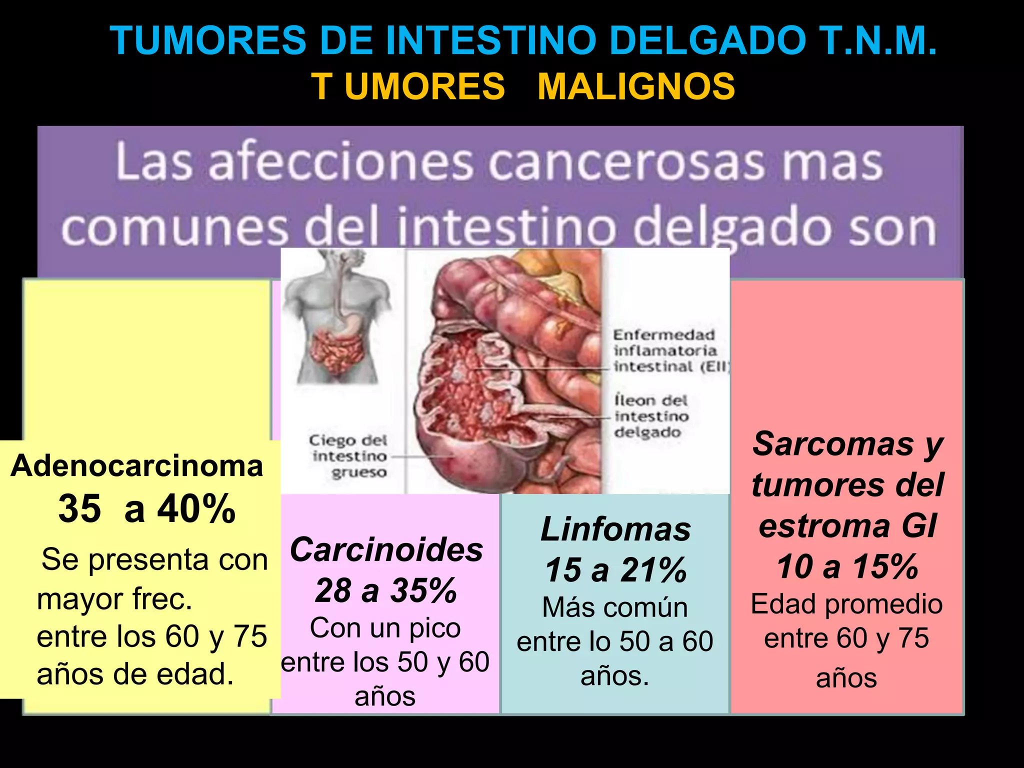 Tumores de intestino delgado tnm. ekipo 6 2 | PPTX