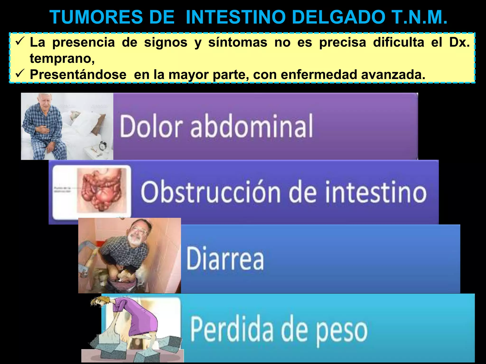 Tumores de intestino delgado tnm. ekipo 6 2 | PPTX