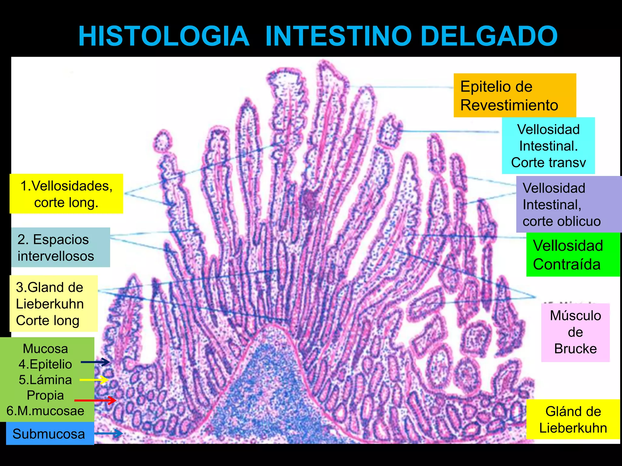 Tumores de intestino delgado tnm. ekipo 6 2 | PPT