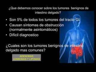 Tumores de intestino delgado tnm. ekipo 6 2 | PPTX