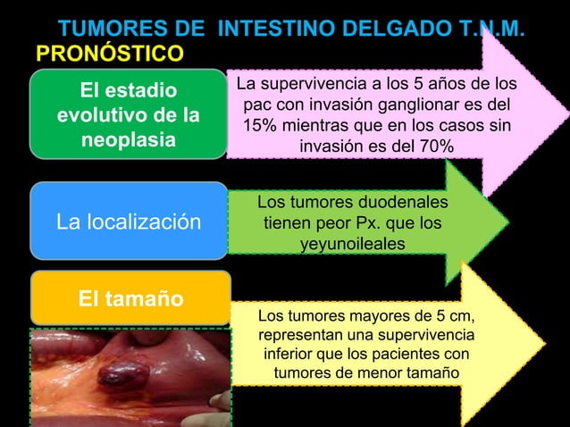 Tumores de intestino delgado tnm. ekipo 6 2 | PPTX