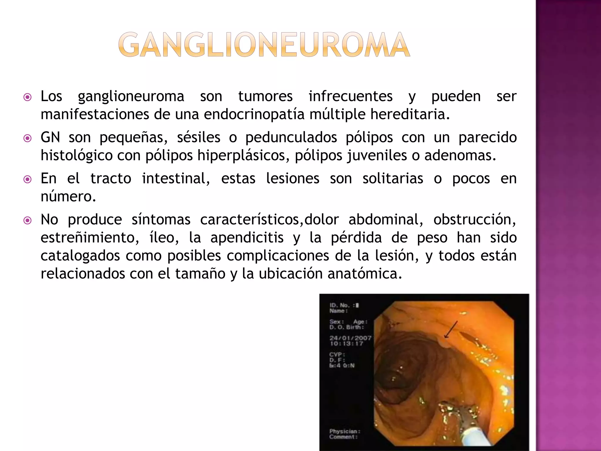Tumores Benignos y Malignos del intestino Delgado | PPTX