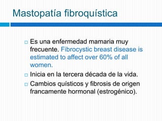 Tumores de mama | PPTX