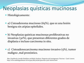 Lesiones Neoplásicas De Pancreas Pptx