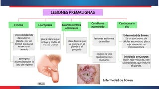 TUMORES GENITALES - UROLOGIA.pptx