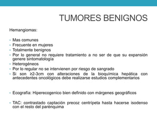 Tumores hepáticos Punto de Vista Radiologico | PPTX