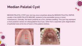 Tumores No Odontogenicos.pptx