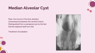 Tumores No Odontogenicos.pptx