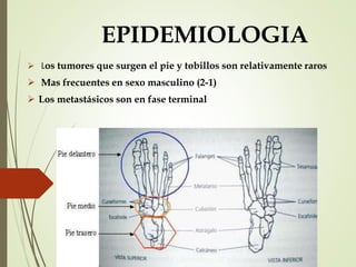 TUMORES OSEOS DEL PIE | PPTX