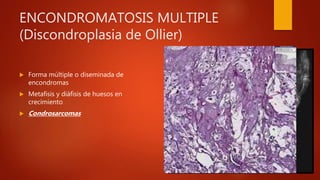 Tumores oseos original. Completa. | PPTX