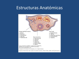 Ovario Tumor De Células Germinales