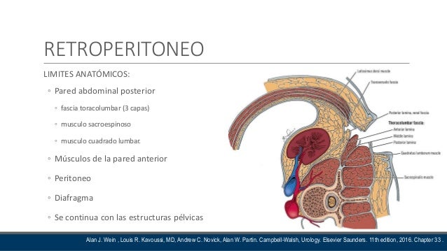 Tumores retroperitoneales