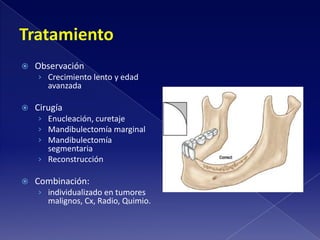 Tumores y pseudotumores mandibulares | PPTX