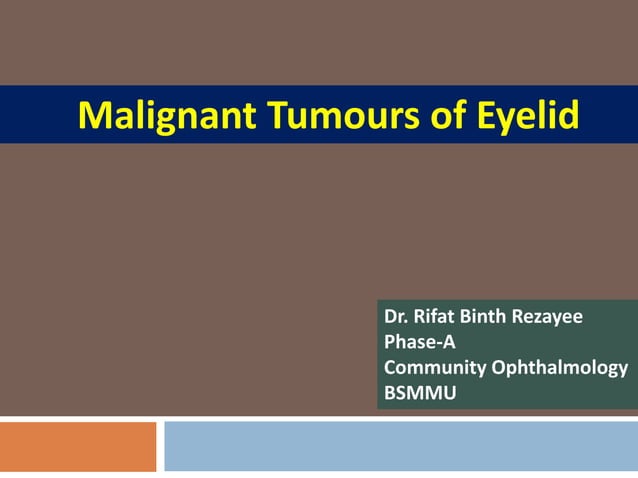 Malignant Tumor of eyelid | PPTX | Eye and Vision Conditions | Diseases and Conditions